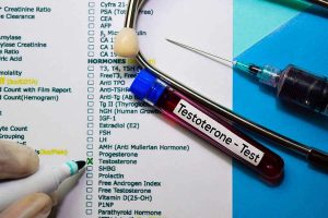 Normal Testosterone Levels by Age | Male and Female Charts | HFS Clinic ...