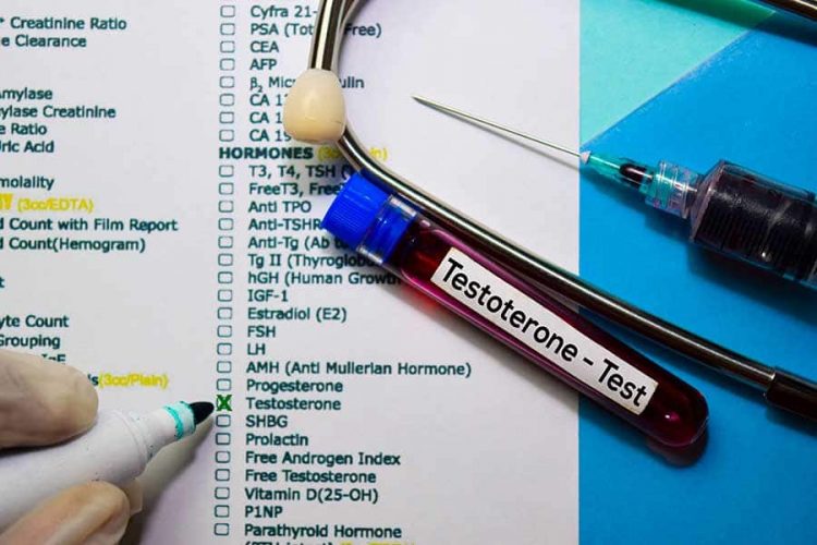 Normal Testosterone Levels by Age | Male and Female Charts | HFS Clinic ...