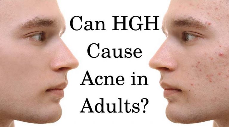 What Does HGH Do to Your Face and Head? | HFS Clinic [HGH & TRT]